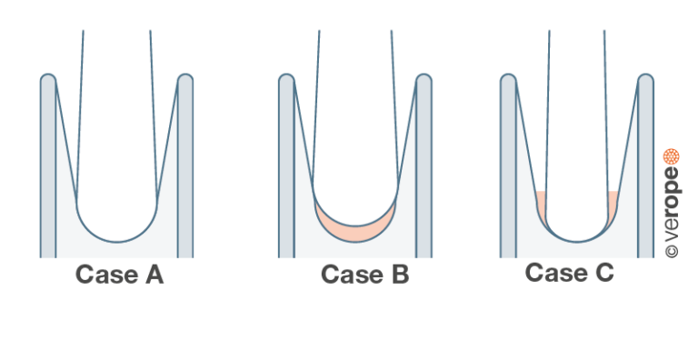 Installation of wire ropes | verope